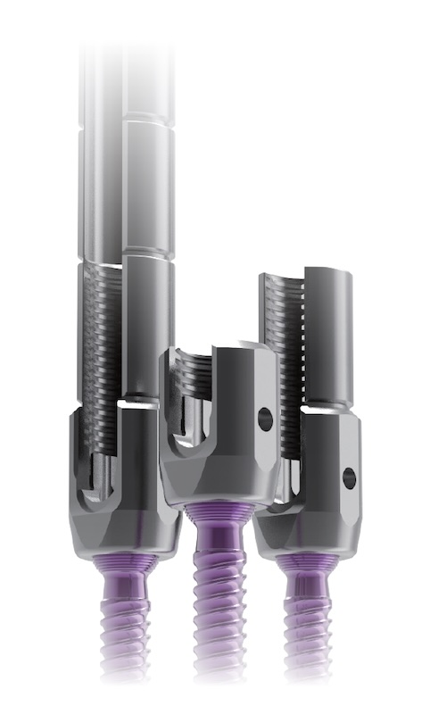 Product-detail | NeuroSpine