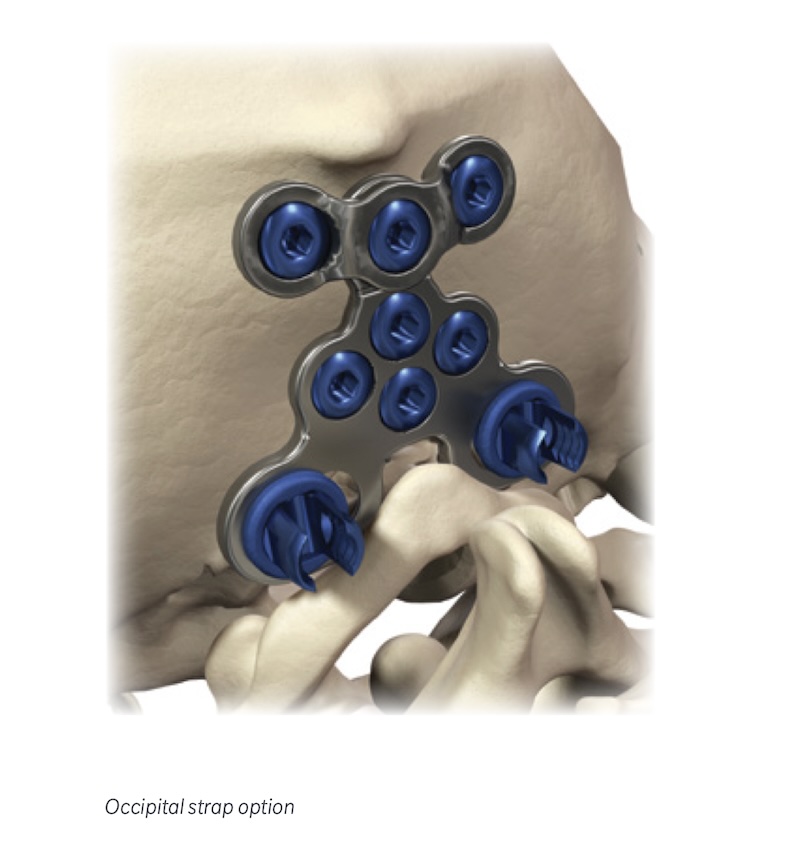 Product-detail | NeuroSpine