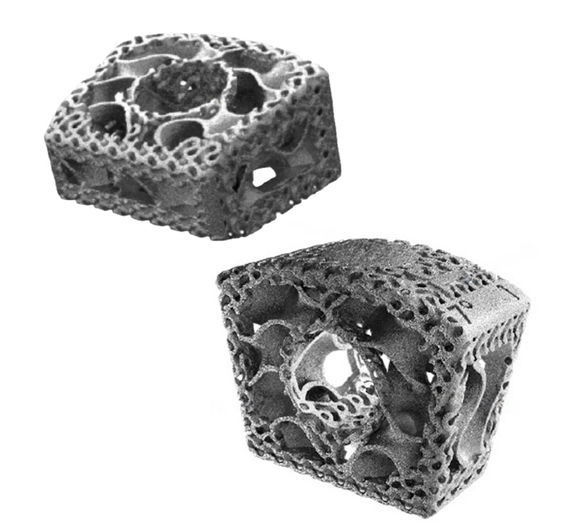 Product-detail | NeuroSpine