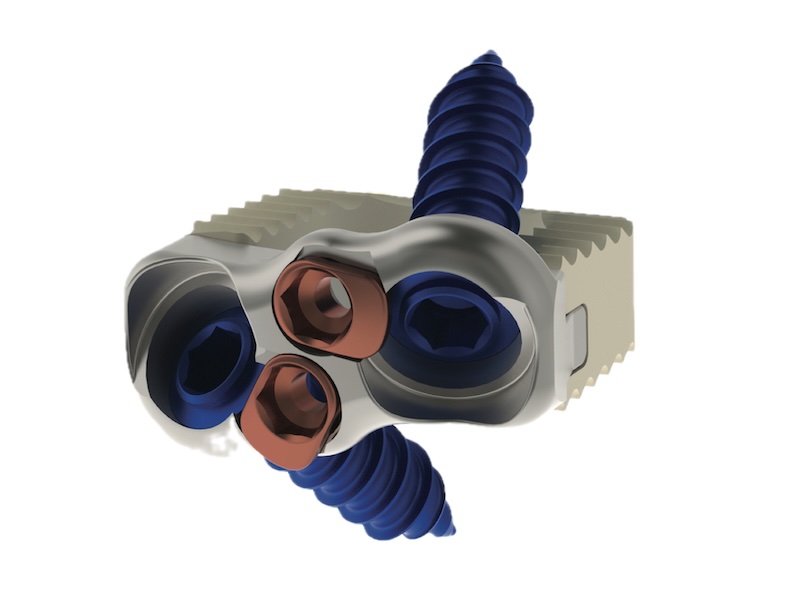 Product-detail | NeuroSpine