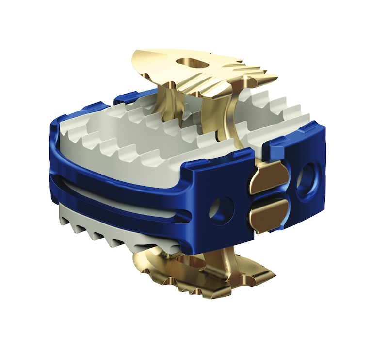 Product-detail | NeuroSpine